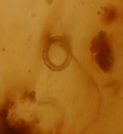 Ancient Carnivorous Fungi Lassoed its Prey (2 | EurekAlert!