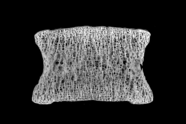 An Image of Normal Bone [IMAGE] | EurekAlert! Science News Releases