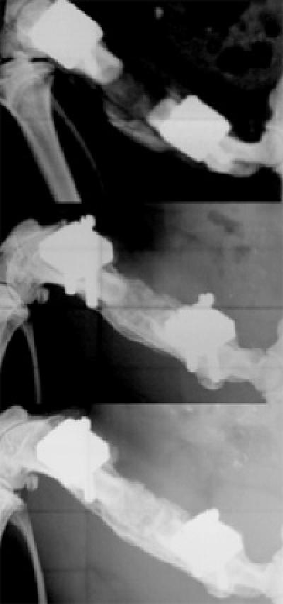 Bone Defect [IMAGE] | EurekAlert! Science News Releases