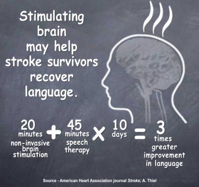 Early brain stimulation may help stroke survi | EurekAlert!