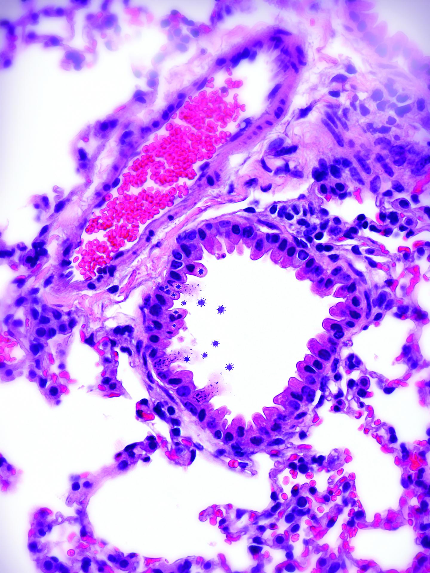 Too Much of a 'Good' Thing Can Kill You, Flu- | EurekAlert!