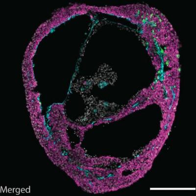 Cardioids -- heartbeat, heartbreak and recove | EurekAlert!