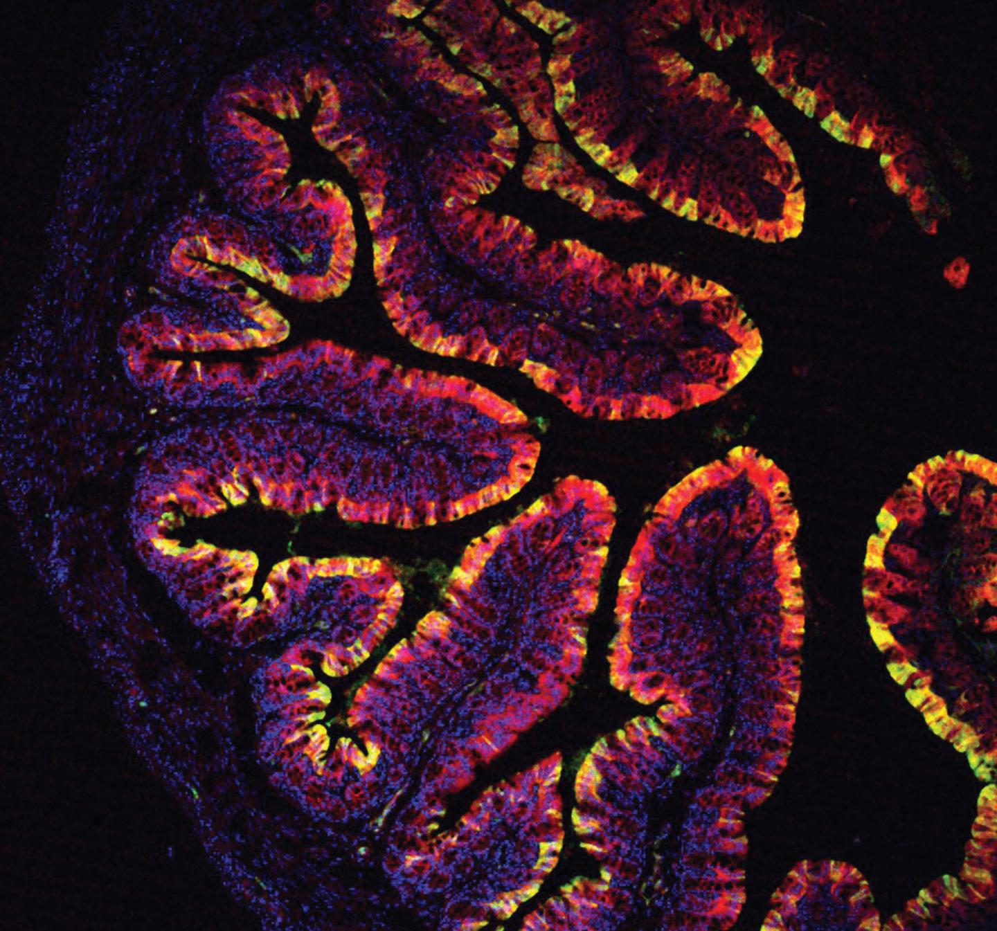 Chemicals found in vegetables prevent colon c | EurekAlert!