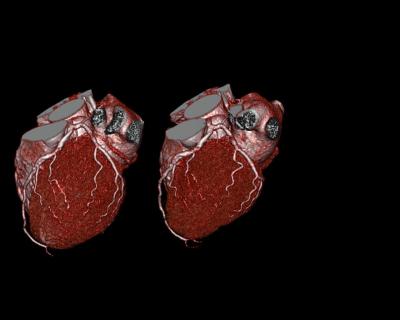 Multi-Slice Computed Tomograph [IMAGE] | EurekAlert! Science News Releases