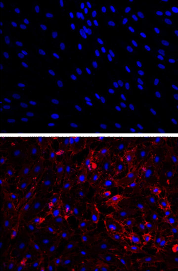 Scar Cells Transformed into Bl [IMAGE] | EurekAlert! Science News Releases