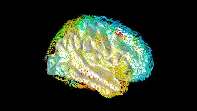 Waves move across the human brain to support | EurekAlert!