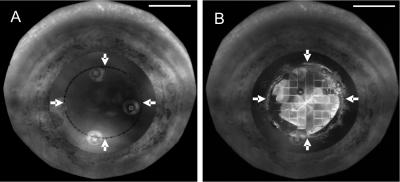 3-D Imaging Guides Femtosecond Laser in Catar | EurekAlert!