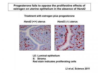 What's Behind Progesterone's Benefits in the | EurekAlert!