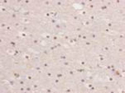 Temporal Neocortex [IMAGE] | EurekAlert! Science News Releases