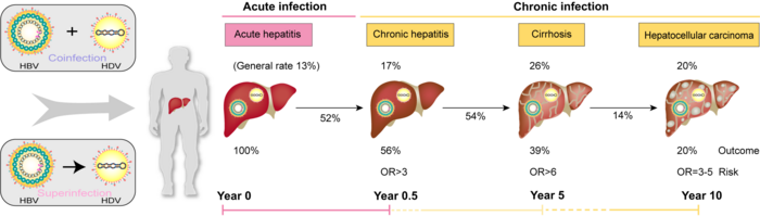 Schematic diagram of hepatitis [IMAGE] | EurekAlert! Science News Releases