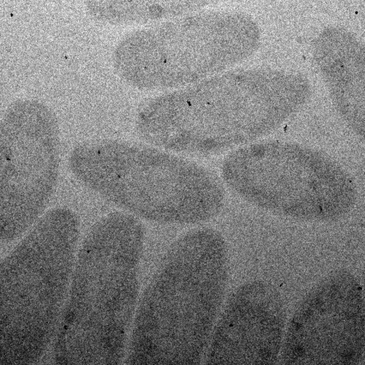 Bacteria with Gold Nanoparticl [IMAGE] | EurekAlert! Science News Releases