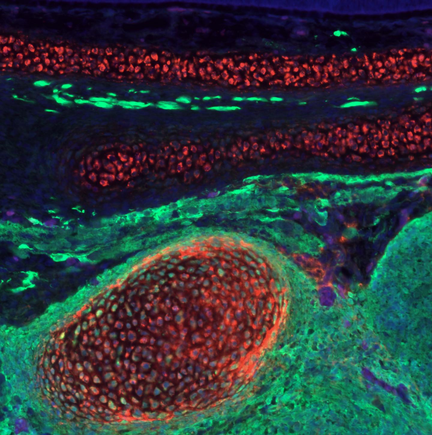 Repurposing Neural Crest Cells [image] Eurekalert Science News Releases