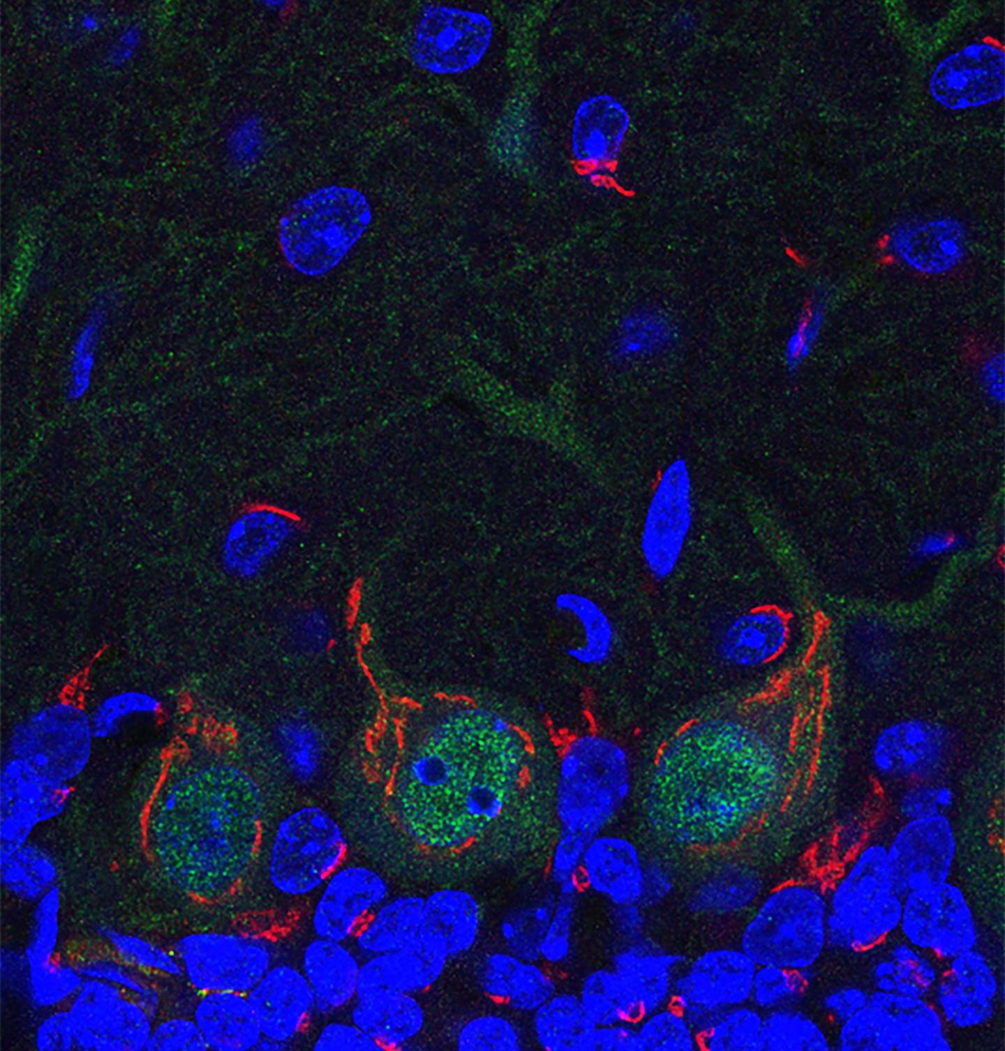 Neurodegeneration (2 of 2) [IMAGE] | EurekAlert! Science News Releases