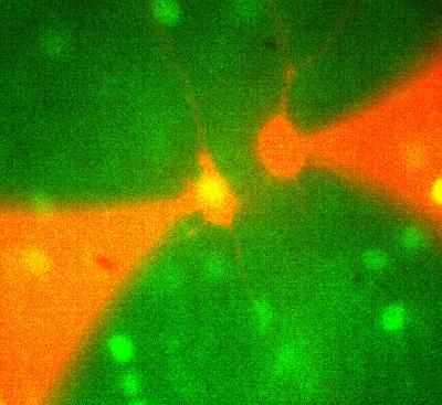 Active Neurons in the Neocorte [IMAGE] | EurekAlert! Science News Releases
