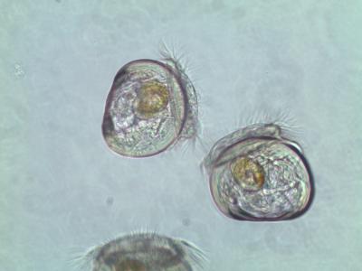 Mussel Larvae [IMAGE] | EurekAlert! Science News Releases