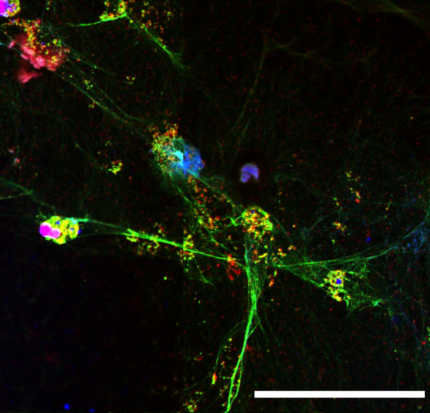 Neutrophils from a COVID-19 Pa [IMAGE] | EurekAlert! Science News Releases