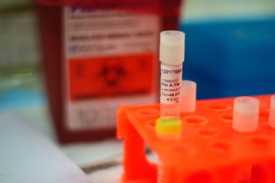 Sequenced Ebola Strains Inform Aspects of Cur | EurekAlert!