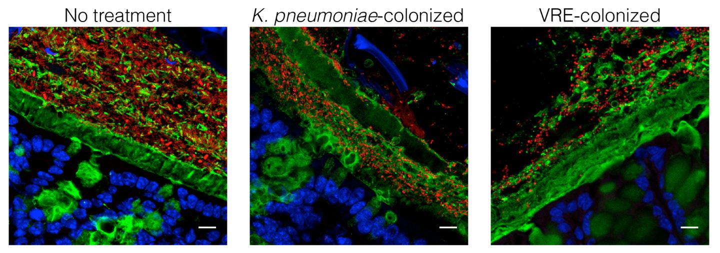 Commensal Bacteria and Colonic [IMAGE] | EurekAlert! Science News Releases