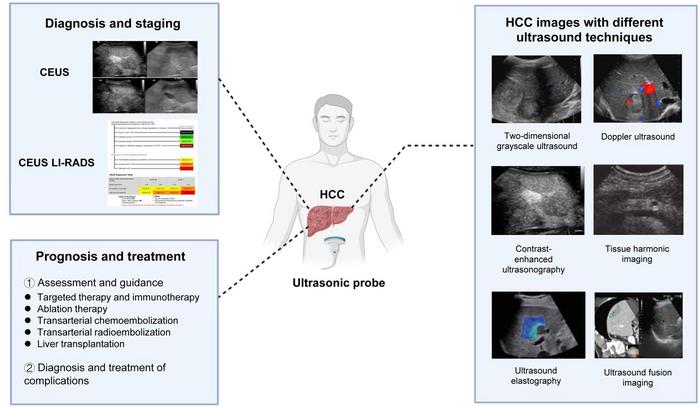 Ultrasonography of Hepatocellu [IMAGE] | EurekAlert! Science News Releases