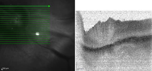 Magnetic Particles Propel the Way to Treatmen | EurekAlert!