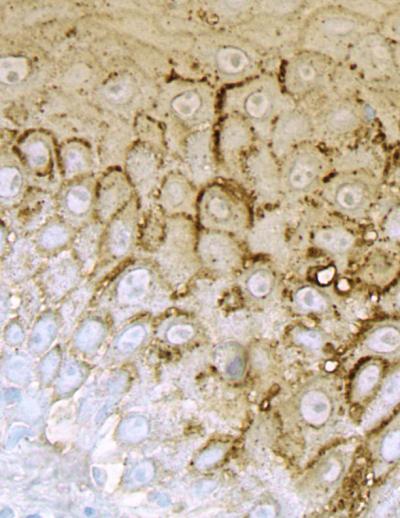 New Blood Test for Skin Graft [IMAGE] | EurekAlert! Science News Releases