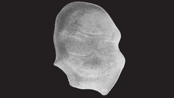 The otoliths of fishes are sma [IMAGE] | EurekAlert! Science News Releases