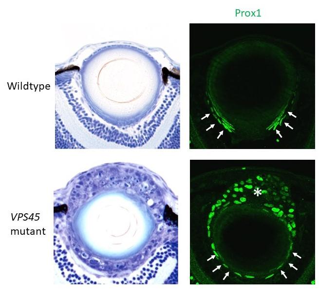 Mutant Lens [IMAGE] | EurekAlert! Science News Releases