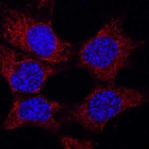 Protecting brain cells with cannabinol | EurekAlert!