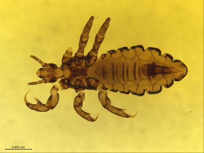 Of lice and man: Researchers sequence human b | EurekAlert!