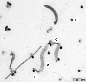 Methanosaeta, a filamentous me [IMAGE] | EurekAlert! Science News Releases