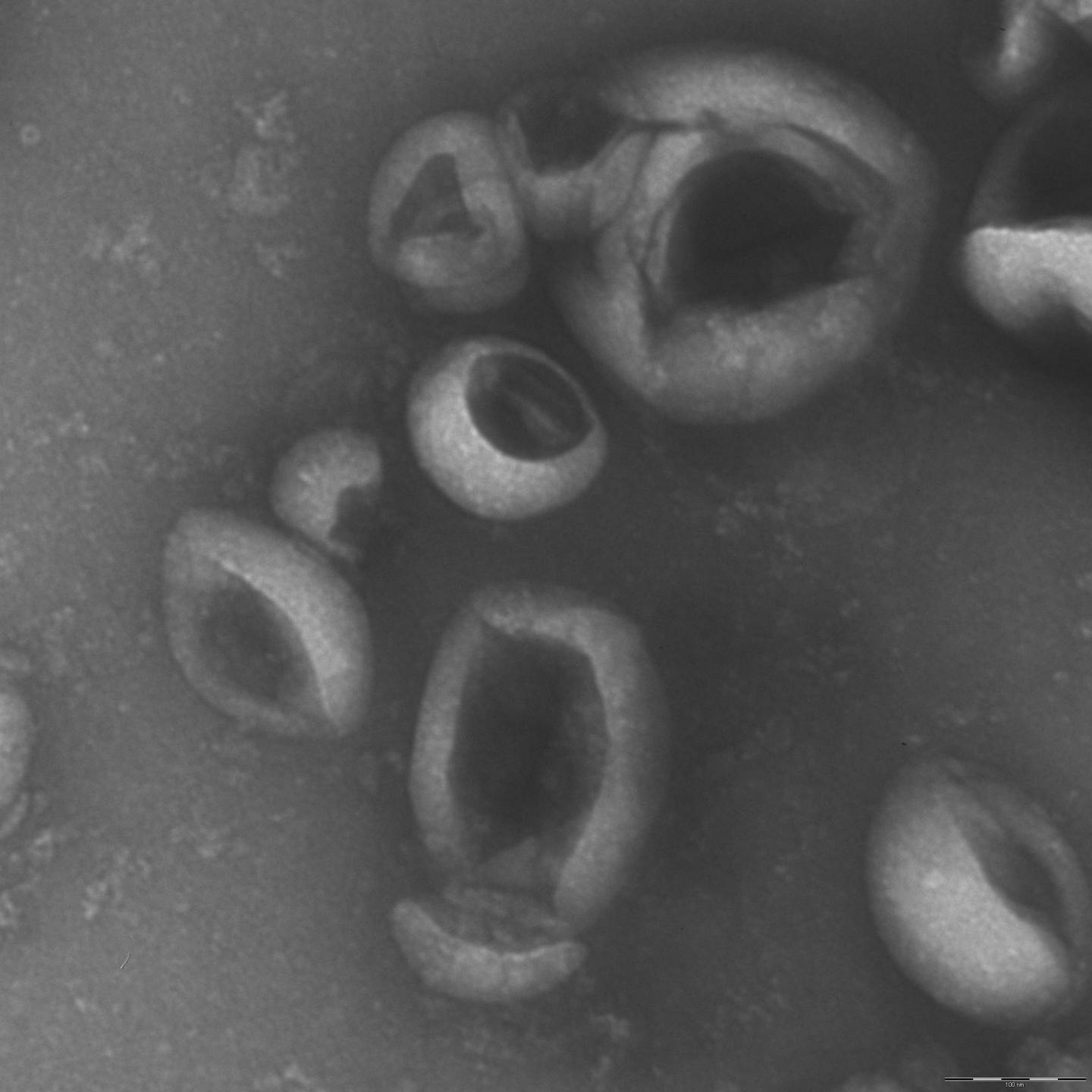 Extracellular Vesicles [IMAGE] | EurekAlert! Science News Releases