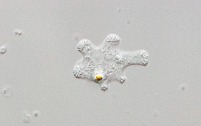 Rediscovery of rare marine amoeba Rhabdamoeba | EurekAlert!