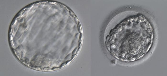 Blastocyst morphology [IMAGE] | EurekAlert! Science News Releases