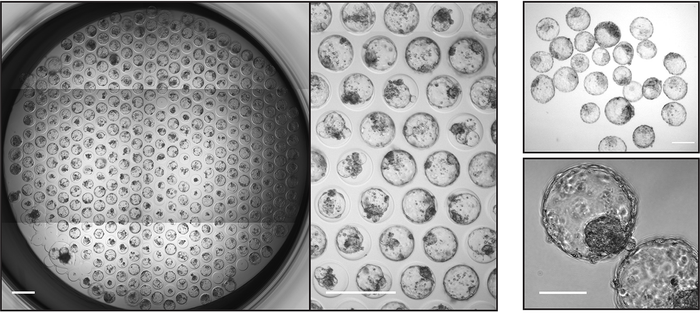 Breakthrough research on human embryo models | EurekAlert!