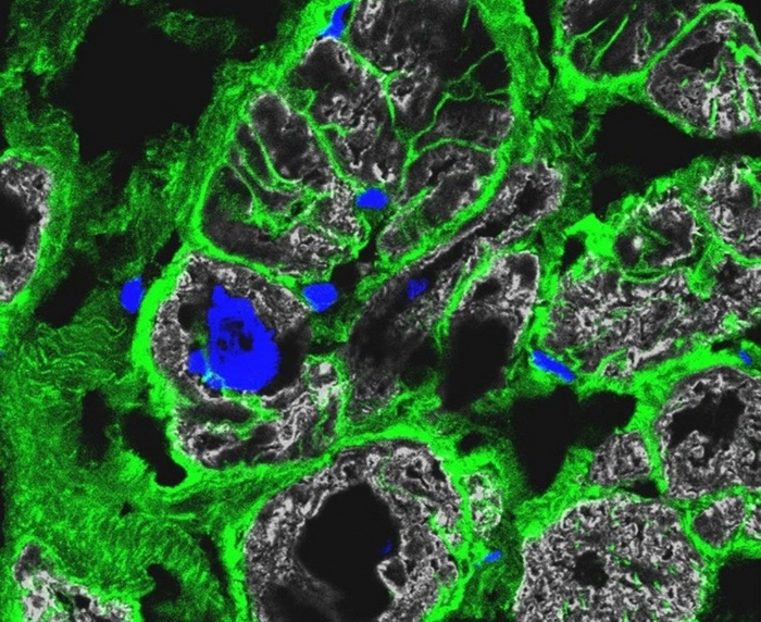 Immunofluorescence staining of [IMAGE] | EurekAlert! Science News Releases