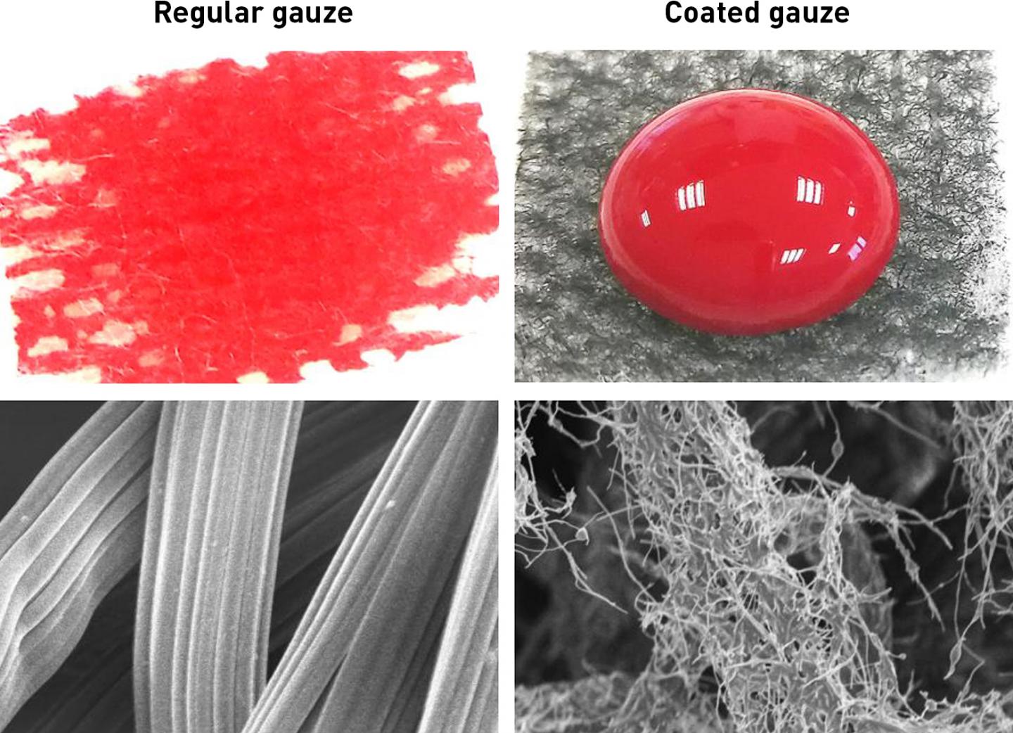 Gauze [IMAGE] | EurekAlert! Science News Releases