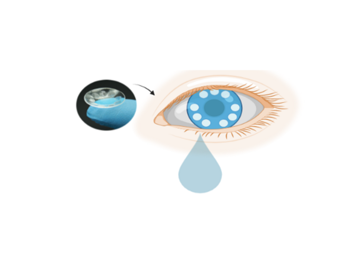 Smart contact lenses for cancer diagnostics a | EurekAlert!