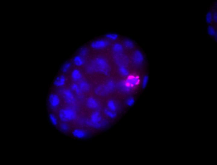 Worm Embryo [IMAGE] | EurekAlert! Science News Releases