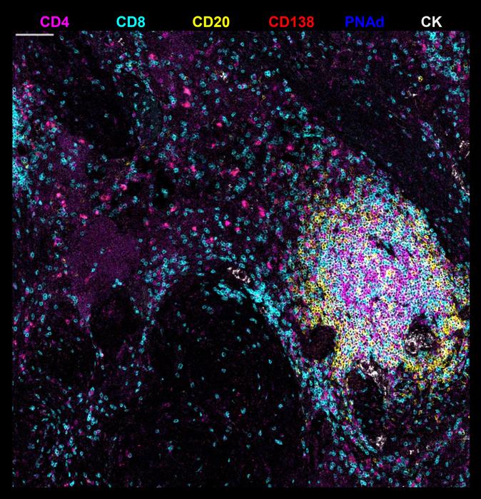 Tertiary lymphoid structure [IMAGE] | EurekAlert! Science News Releases