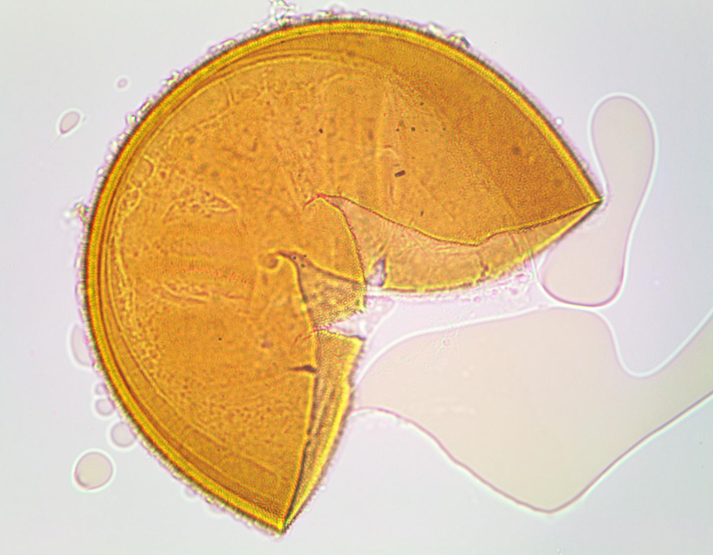 Acaulospora spinosa Spo [IMAGE] | EurekAlert! Science News Releases