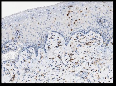 Tissue Stained for Cells Conta [IMAGE] | EurekAlert! Science News Releases