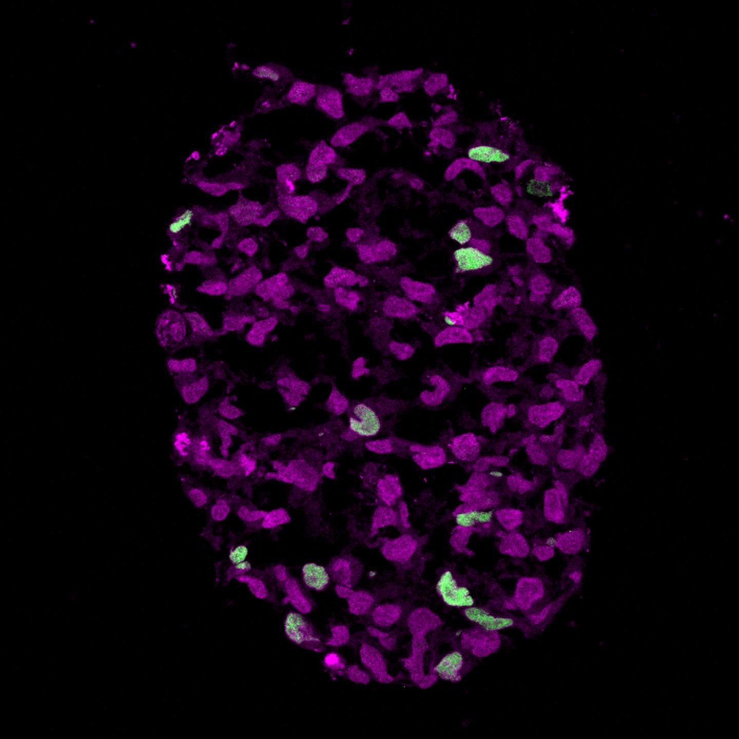 Birth of the Human Germ Cell L [IMAGE] | EurekAlert! Science News Releases