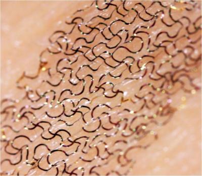 Stretchable Electronic 'Skin' (7 of 9) | EurekAlert!