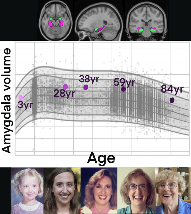Growth charts for the brain help to understan | EurekAlert!