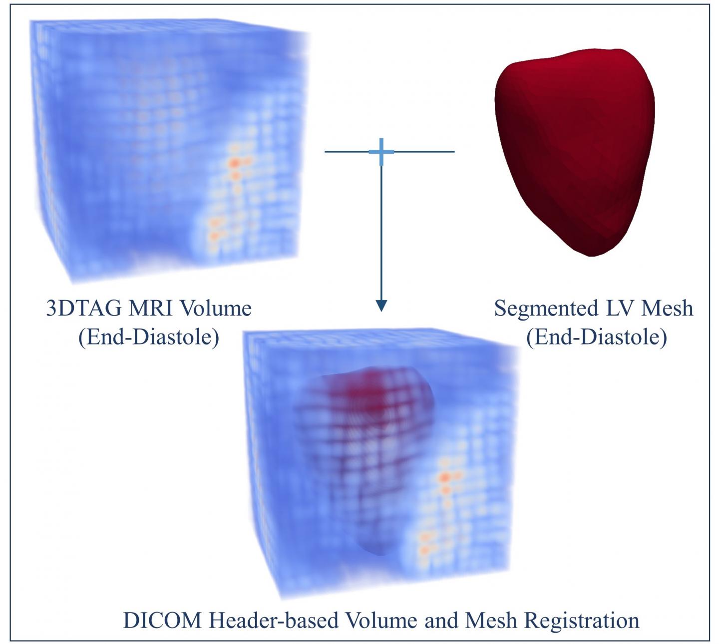 The 3DTag MRI Volume, and Segm [IMAGE] | EurekAlert! Science News Releases