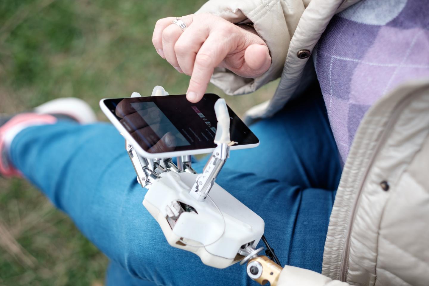 The Prosthesis Has Been Succes [IMAGE] | EurekAlert! Science News Releases