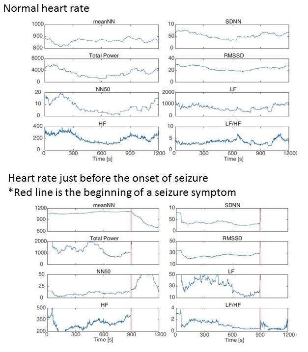 Traditional Analysis of Heart [IMAGE] | EurekAlert! Science News Releases
