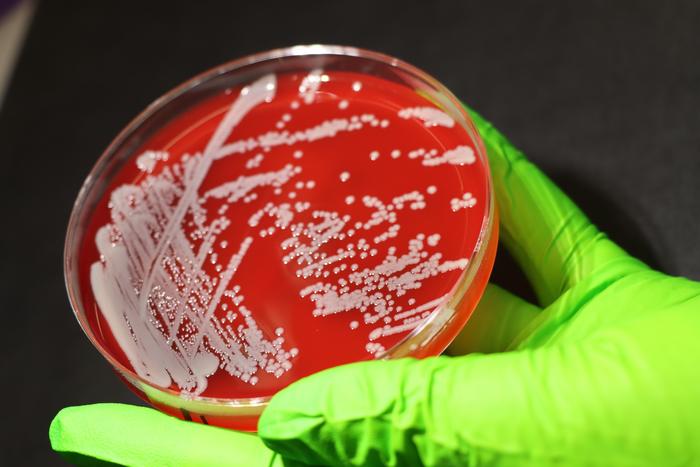 Staphylococcus aureus growing [IMAGE] | EurekAlert! Science News Releases
