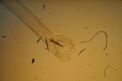 Back of Haemonchus contortu [IMAGE] | EurekAlert! Science News Releases