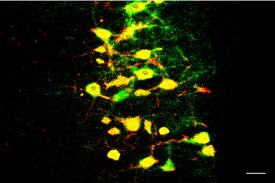 After Nerve Root Avulsion [IMAGE] | EurekAlert! Science News Releases